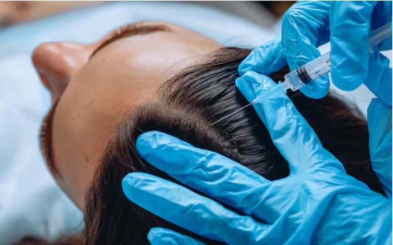 How PRP Hair Restoration in Turkey Can Transform Your Hair